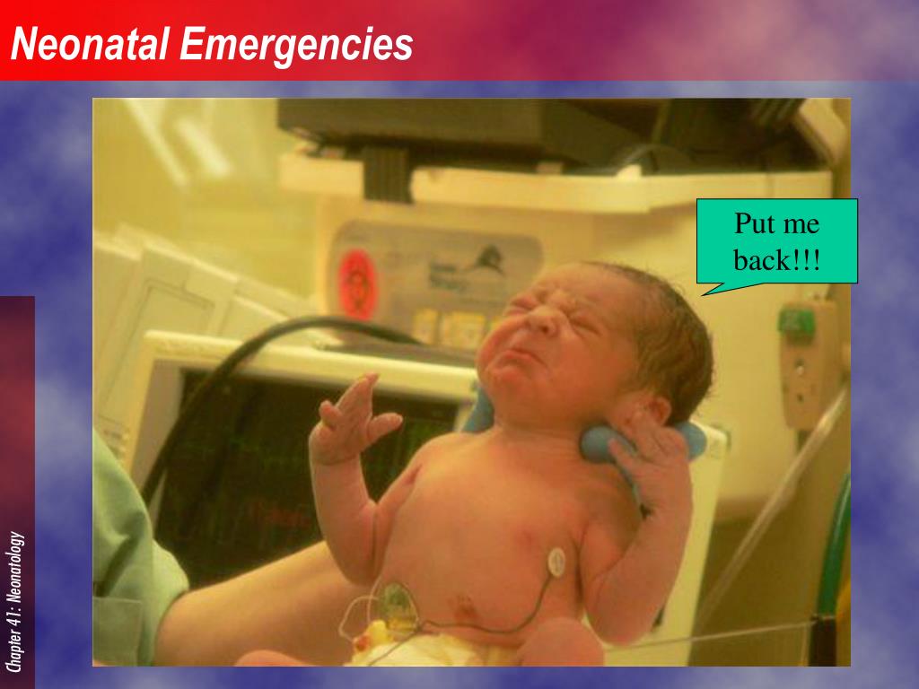 PPT - Neonatal Emergencies PowerPoint Presentation, free download - ID ...