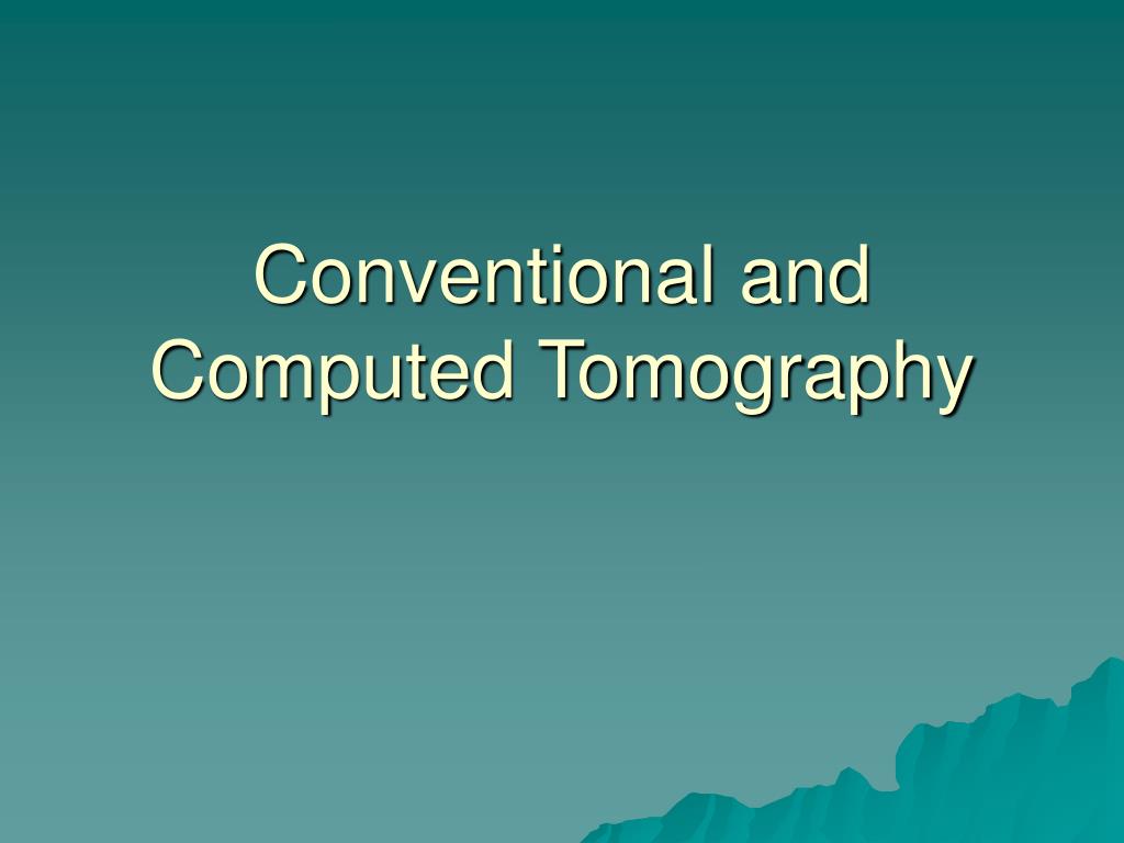 PPT - Conventional and Computed Tomography PowerPoint Presentation ...
