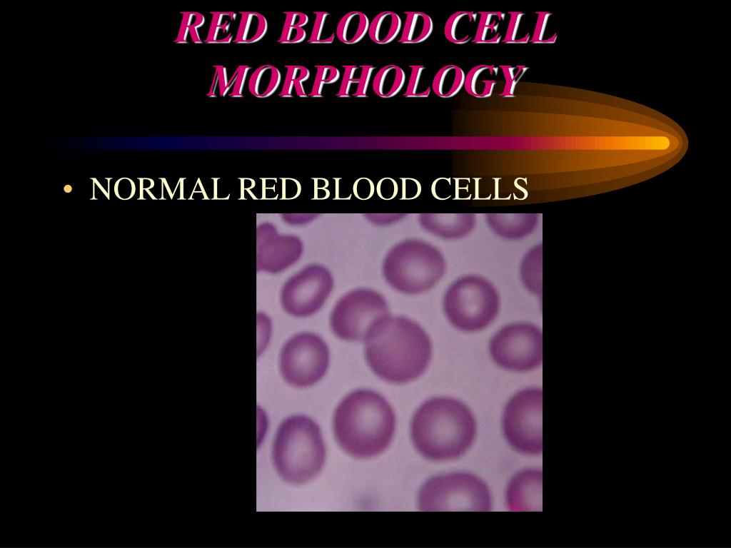 PPT - RED BLOOD CELL MORPHOLOGY PowerPoint Presentation, free download ...