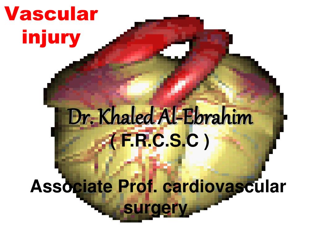 PPT - Vascular injury PowerPoint Presentation, free download - ID:360652