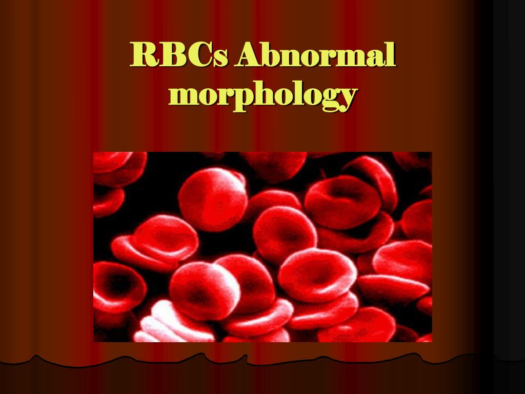 PPT - RBCs Abnormal morphology PowerPoint Presentation, free download ...