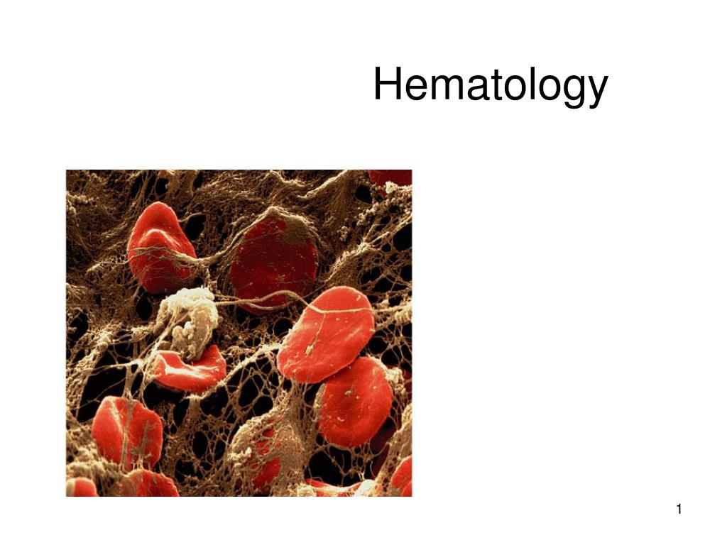PPT - Hematology PowerPoint Presentation, free download - ID:381513