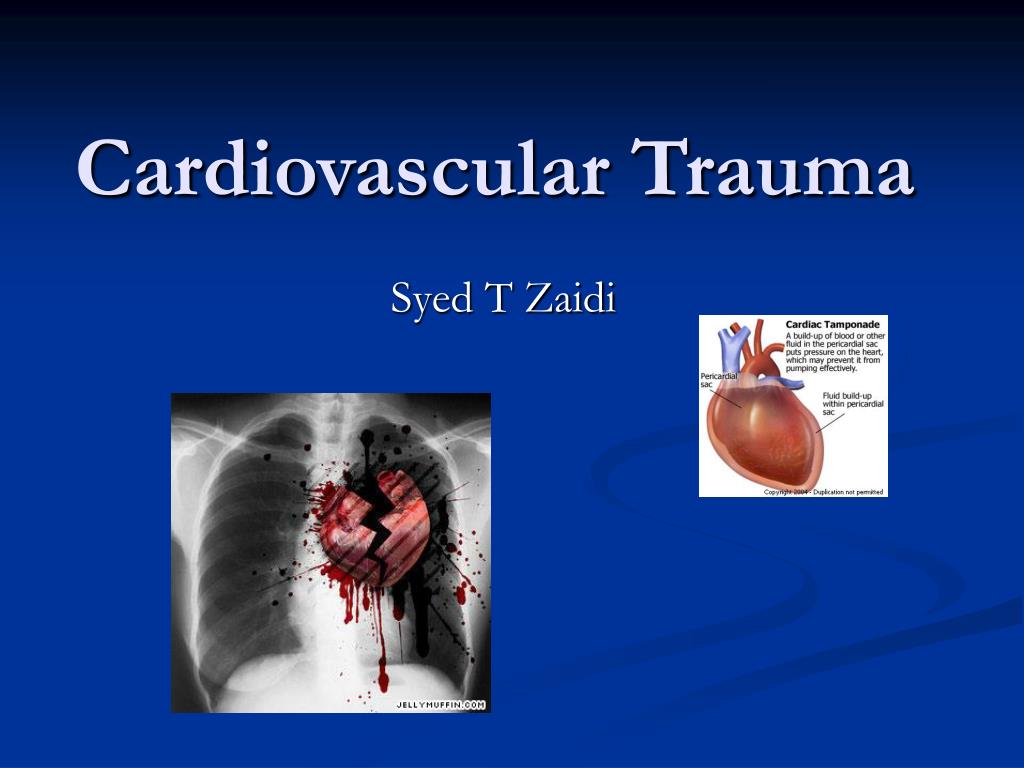 PPT - Cardiovascular Trauma PowerPoint Presentation, free download - ID ...