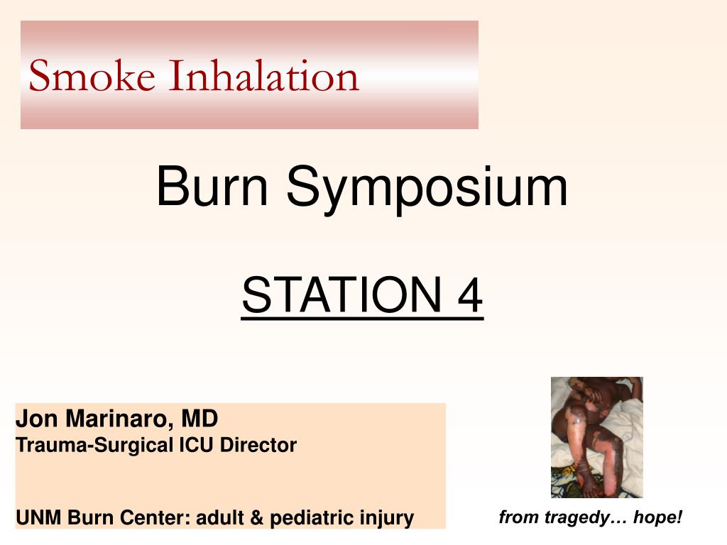 PPT - Smoke Inhalation PowerPoint Presentation, free download - ID:394256