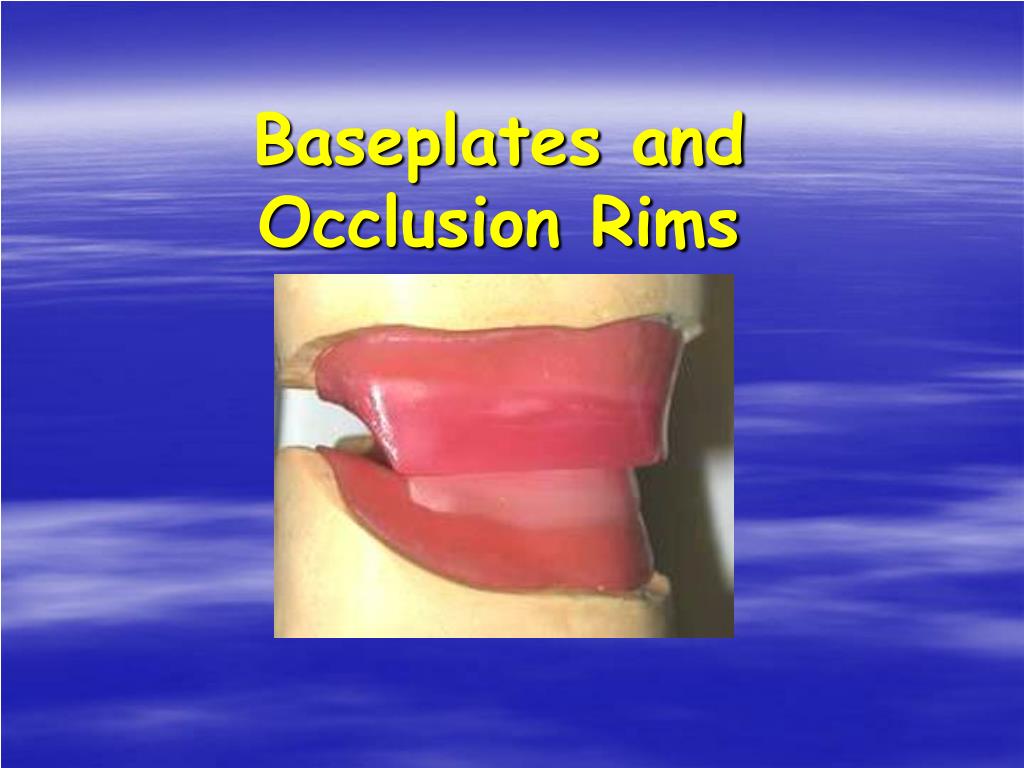 PPT - Baseplates and Occlusion Rims PowerPoint Presentation, free ...
