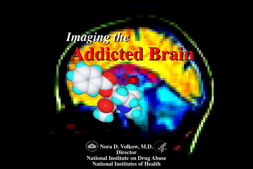 PPT - Imaging the Addicted Brain PowerPoint Presentation, free download ...
