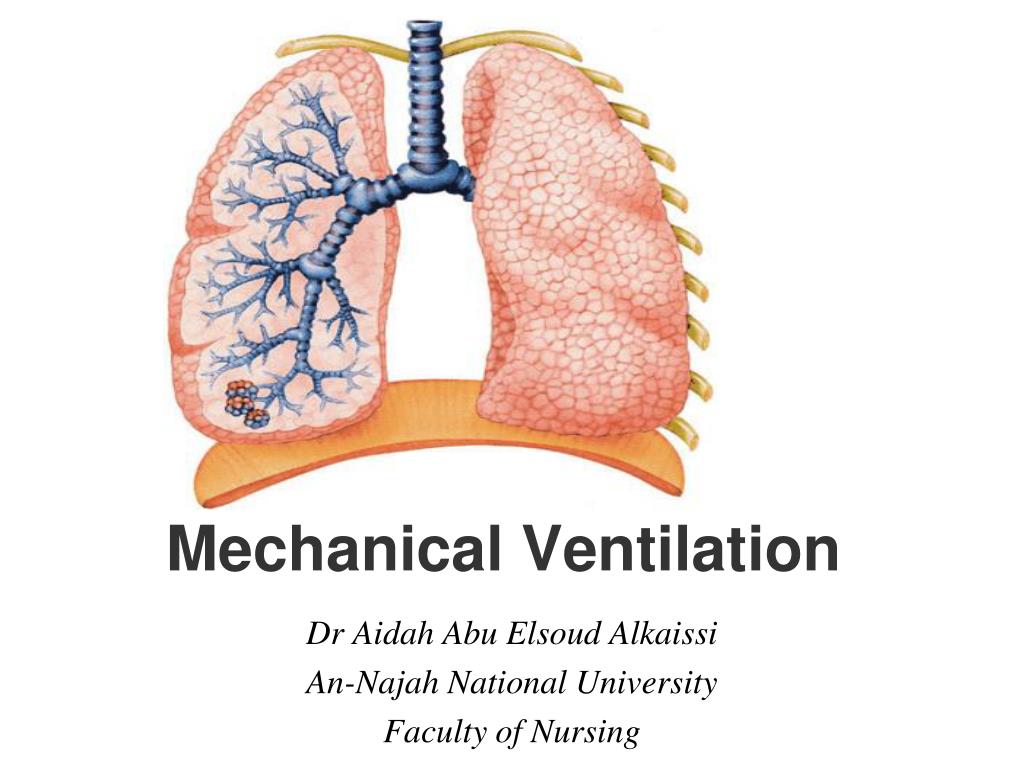 PPT - Mechanical Ventilation PowerPoint Presentation, free download ...