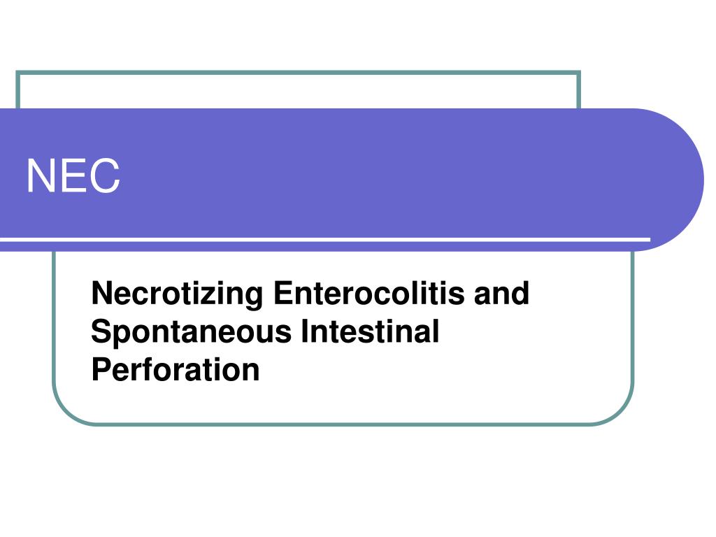 PPT - NEC PowerPoint Presentation, free download - ID:457091