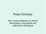 PPT - Pulse Oximetry PowerPoint Presentation, free download - ID:4919280