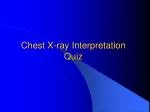 PPT - Basics of Chest X-Ray PowerPoint Presentation, free download - ID ...
