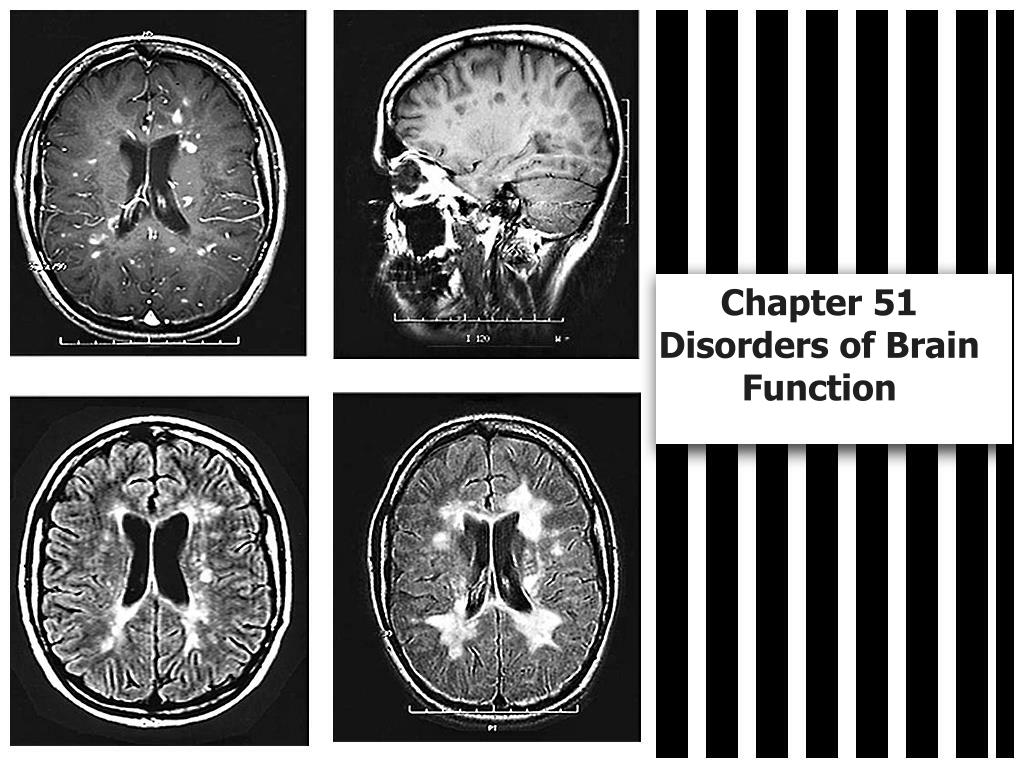 PPT - Chapter 51 Disorders of Brain Function PowerPoint Presentation ...