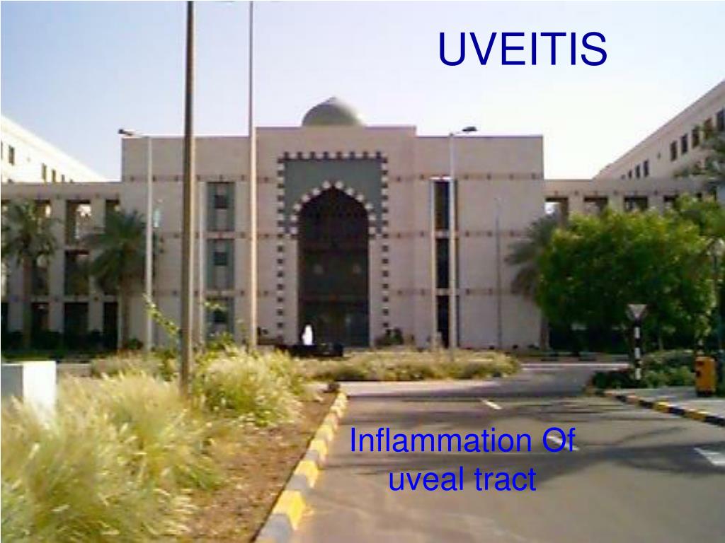 PPT - UVEITIS PowerPoint Presentation, free download - ID:510181