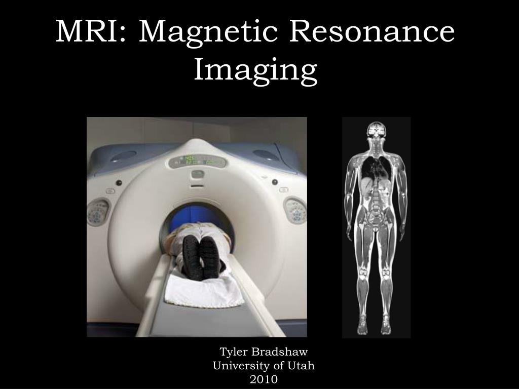 PPT - MRI: Magnetic Resonance Imaging PowerPoint Presentation, free ...