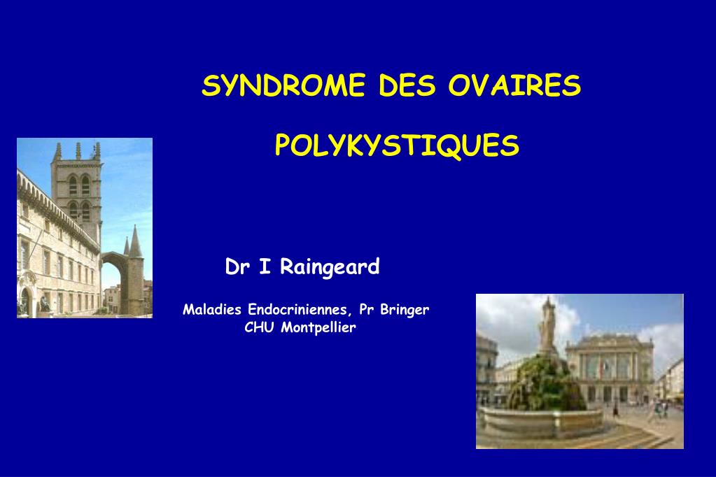 PPT - SYNDROME DES OVAIRES PowerPoint Presentation, free download - ID ...