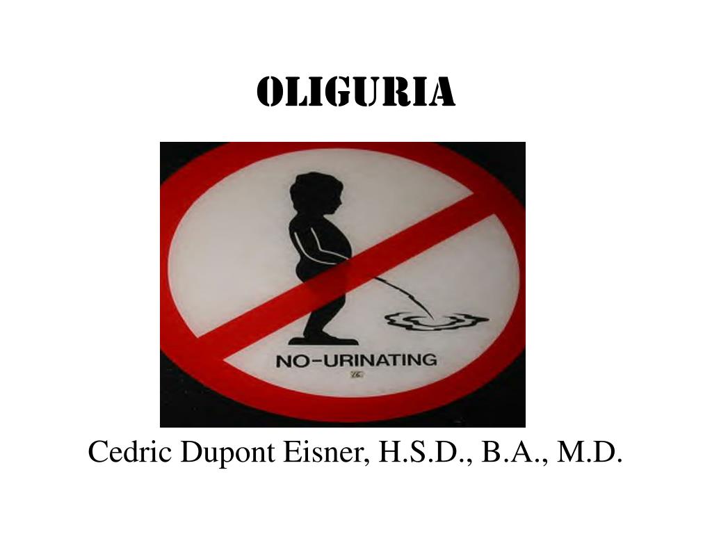PPT - Oliguria PowerPoint Presentation, free download - ID:561495