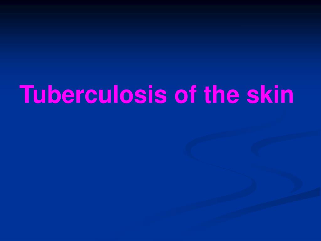 PPT - Tuberculosis of the skin PowerPoint Presentation, free download ...