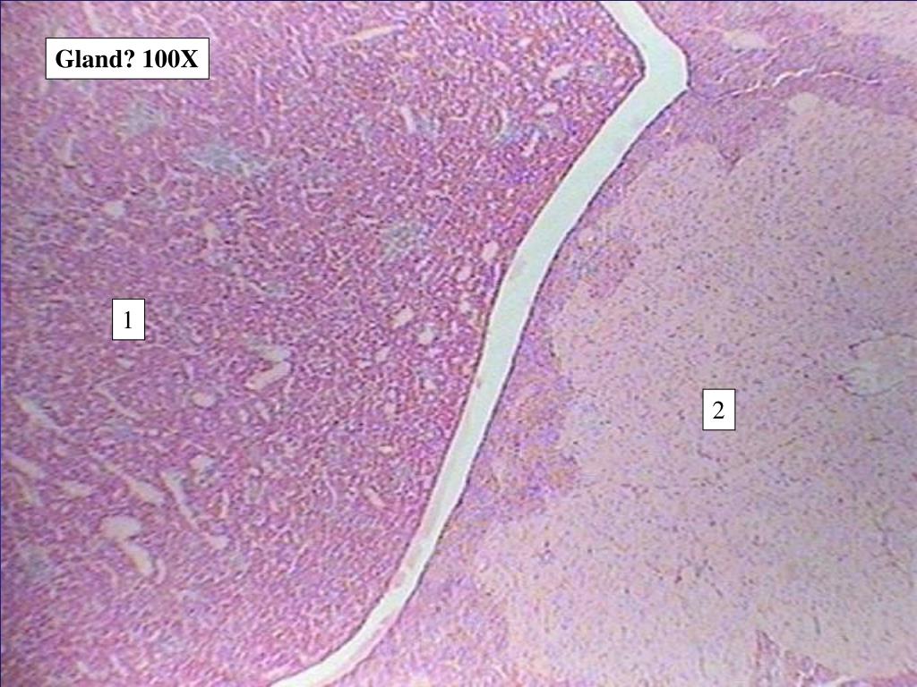 PPT - Gland? 100X PowerPoint Presentation, free download - ID:580108