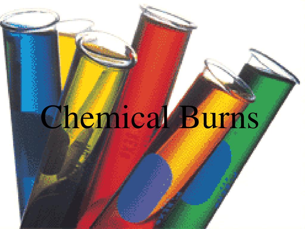 PPT - Chemical Burns PowerPoint Presentation, free download - ID:612930
