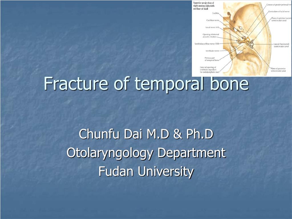 PPT - Fracture of temporal bone PowerPoint Presentation, free download ...