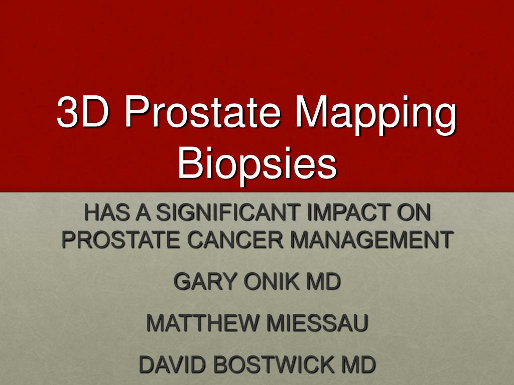 PPT - 3D Prostate Mapping Biopsies PowerPoint Presentation, free ...