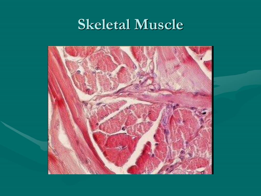 PPT - Skeletal Muscle PowerPoint Presentation, free download - ID:628492