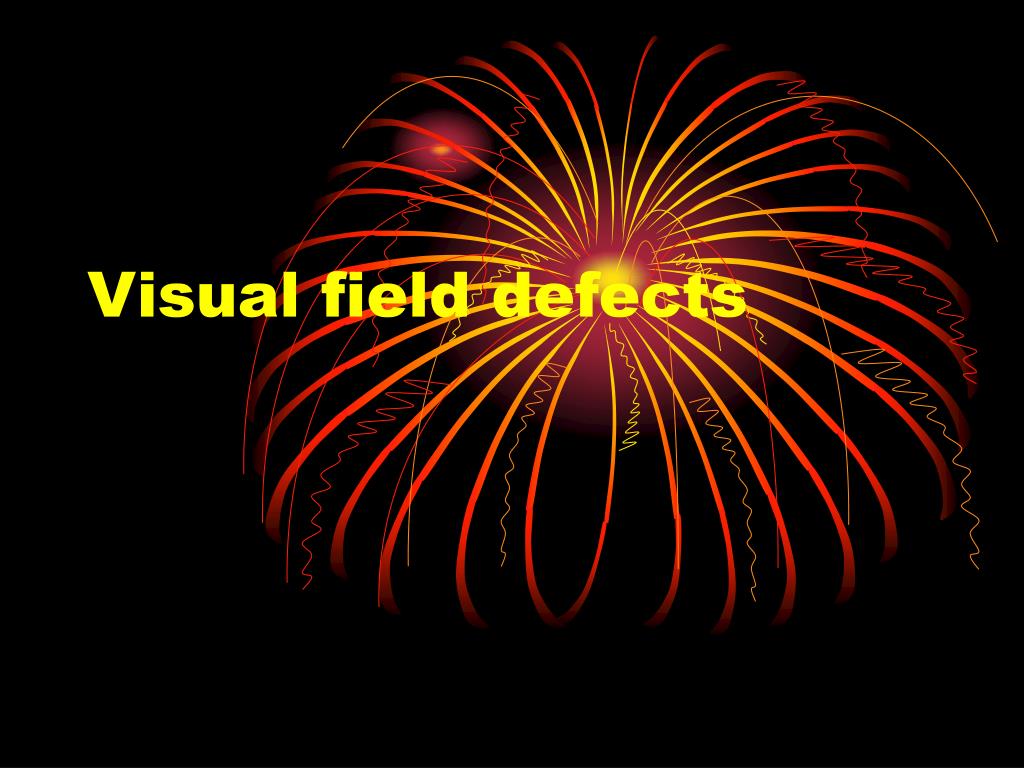 PPT - Visual field defects PowerPoint Presentation, free download - ID ...