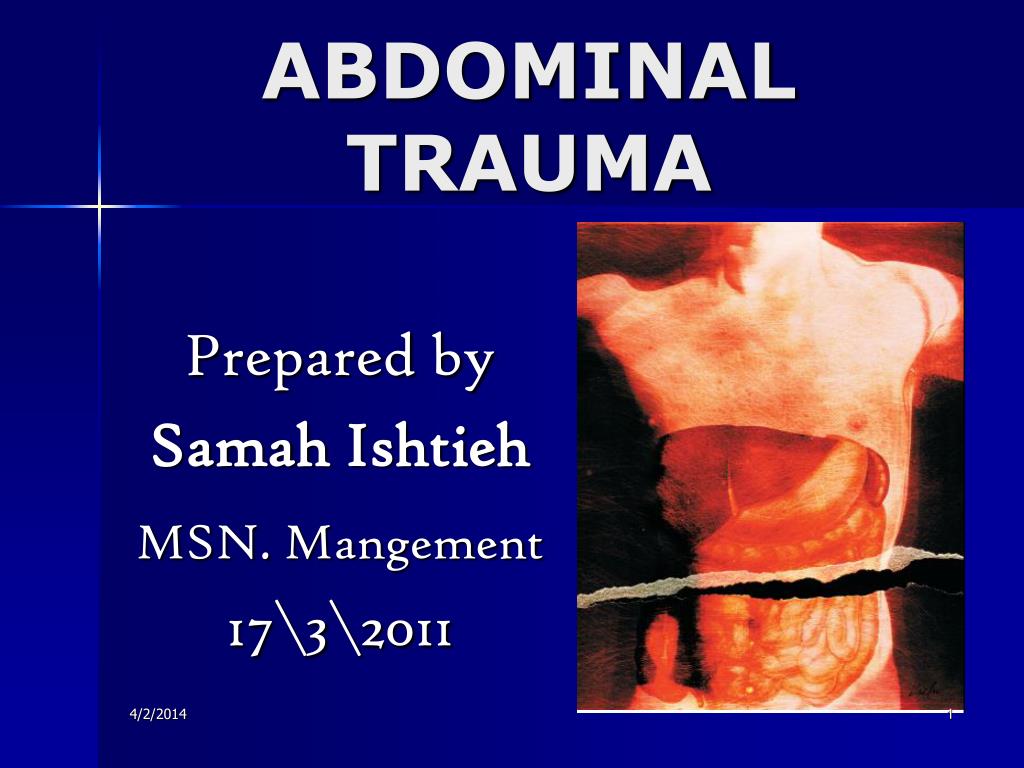 PPT - ABDOMINAL TRAUMA PowerPoint Presentation, free download - ID:637017