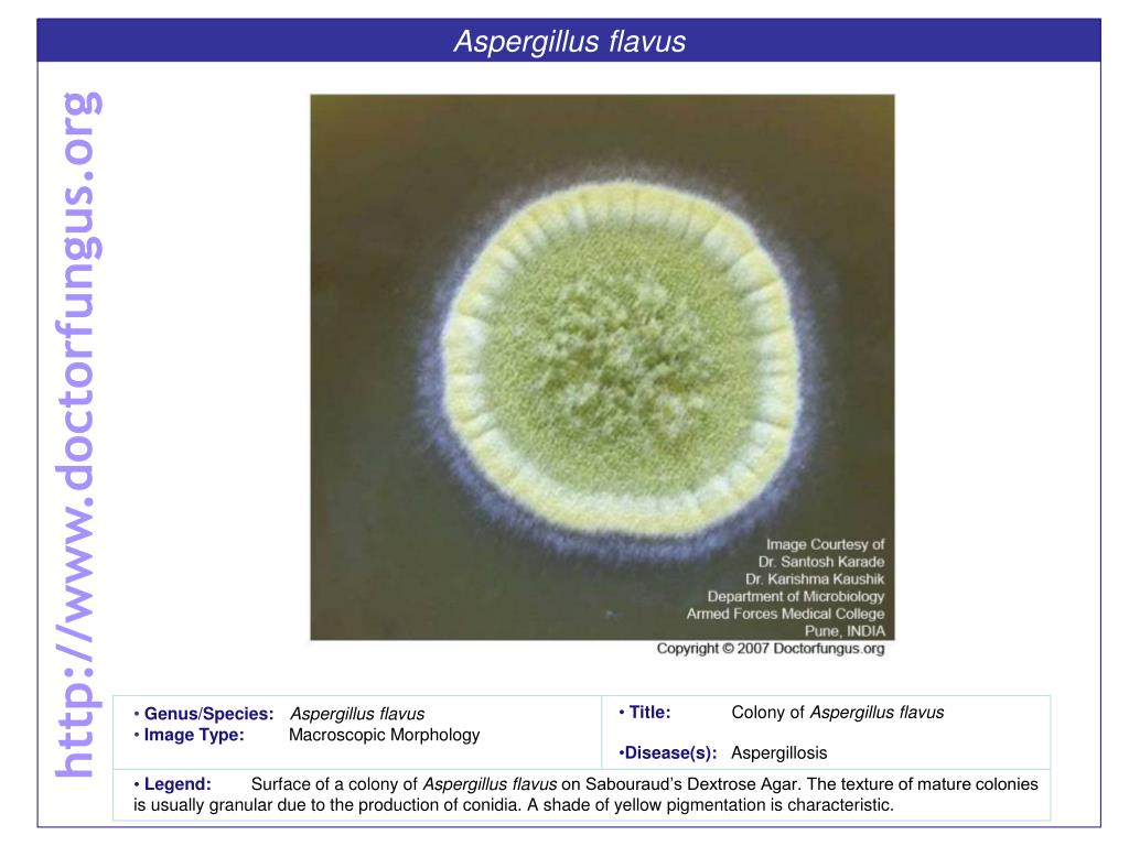 PPT - Aspergillus flavus PowerPoint Presentation, free download - ID:664994