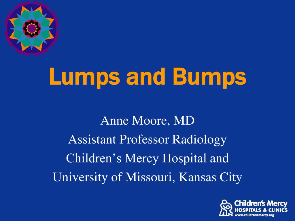 PPT - Lumps and Bumps PowerPoint Presentation, free download - ID:705436