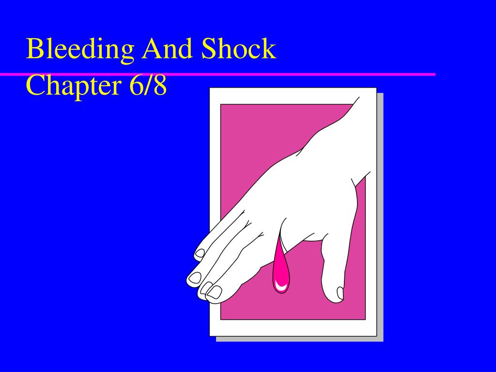 PPT - Bleeding And Shock Chapter 6/8 PowerPoint Presentation, free ...