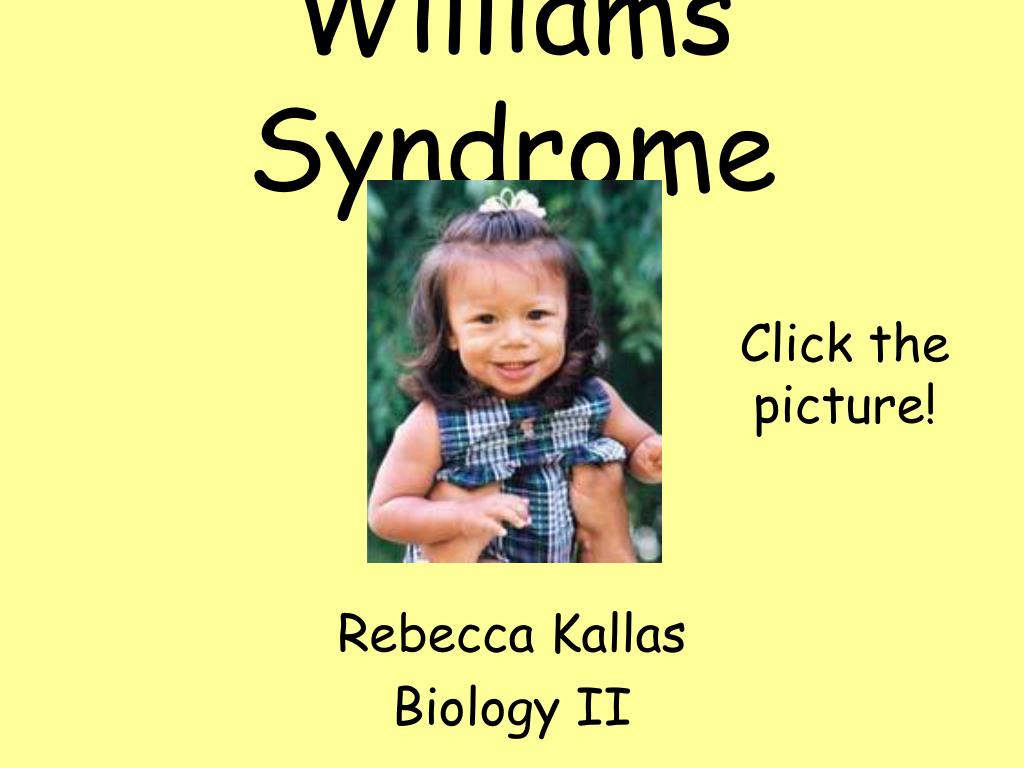 PPT - Williams Syndrome PowerPoint Presentation, free download - ID:729648