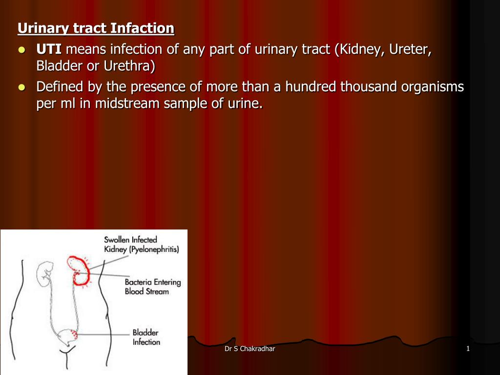 PPT - Urinary tract Infaction UTI means infection of any part of ...