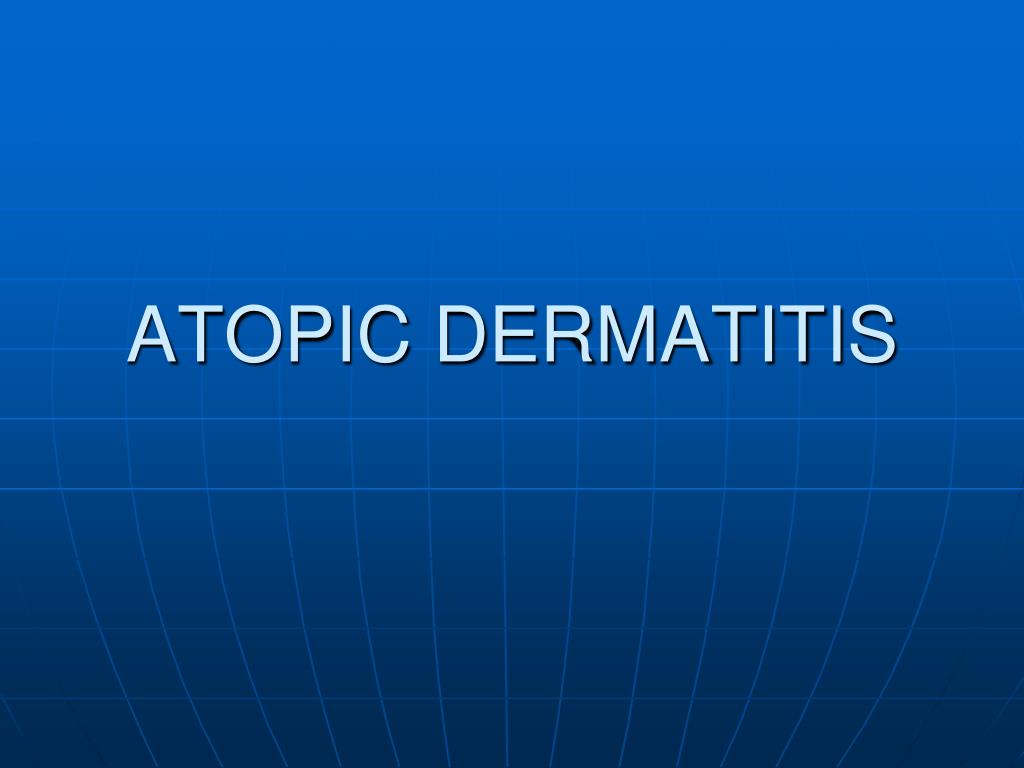PPT - ATOPIC DERMATITIS PowerPoint Presentation, free download - ID:756740