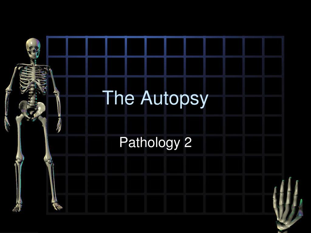 PPT - The Autopsy PowerPoint Presentation, free download - ID:799535