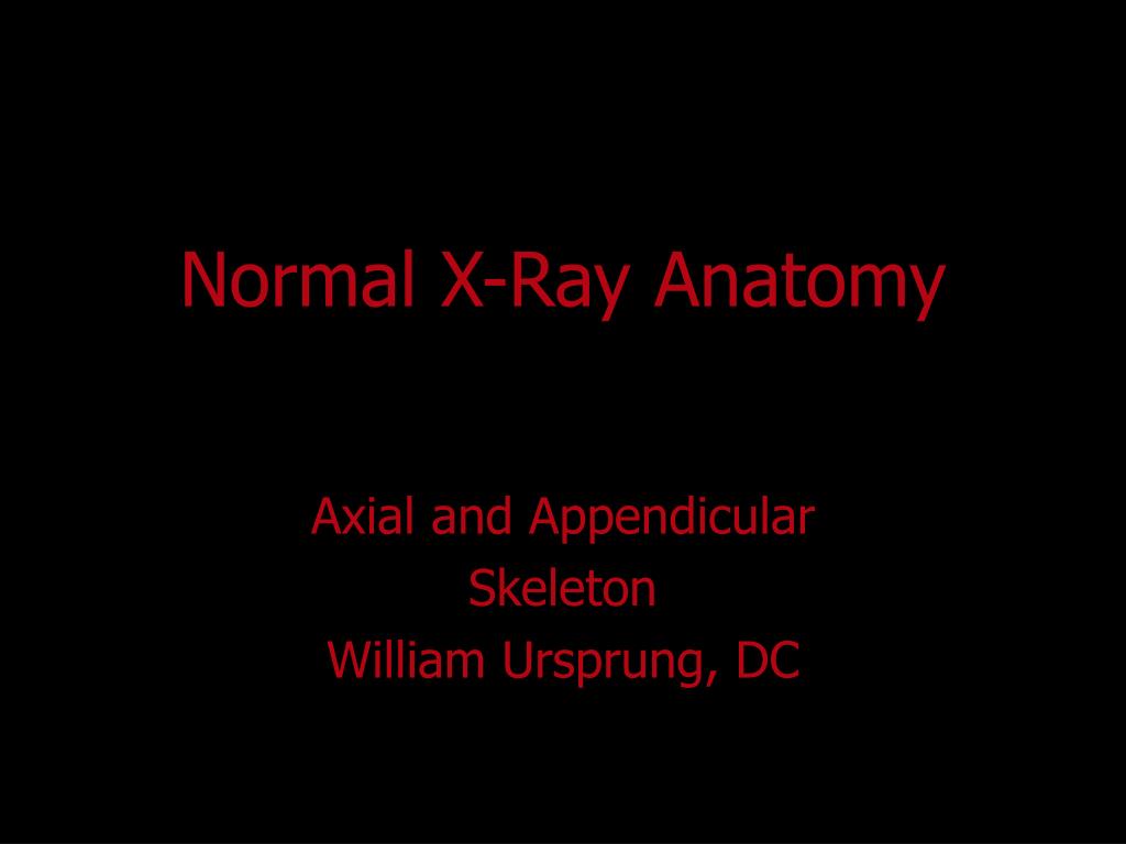 PPT - Normal X-Ray Anatomy PowerPoint Presentation, free download - ID ...