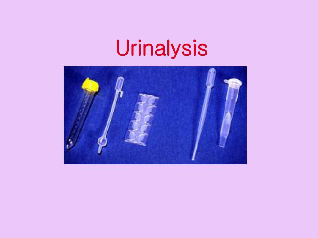 PPT - Urinalysis PowerPoint Presentation, free download - ID:871715