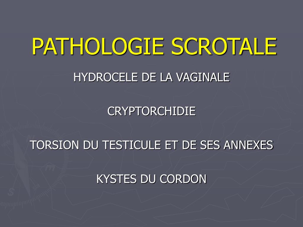 PPT - PATHOLOGIE SCROTALE PowerPoint Presentation, free download - ID ...