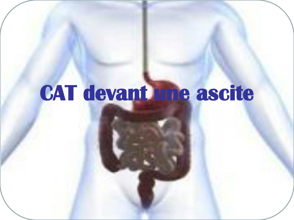 PPT - CAT devant une ascite PowerPoint Presentation, free download - ID:948199