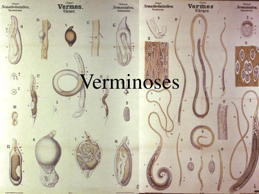 PPT - Verminoses PowerPoint Presentation, free download - ID:959584